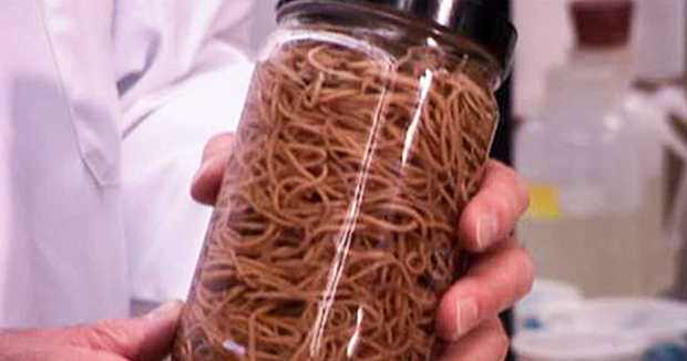 The Doctors Found A Unique Parasite Inside An Infant. What The Parasite ...